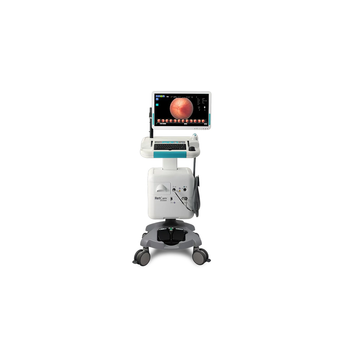 RetCam Envision fundus camera for neonatal and paediatric studies | Kavita